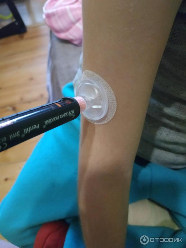Отзыв о Порт для инъекций Medtronic i-Port Advance | Ребенок доволен ...